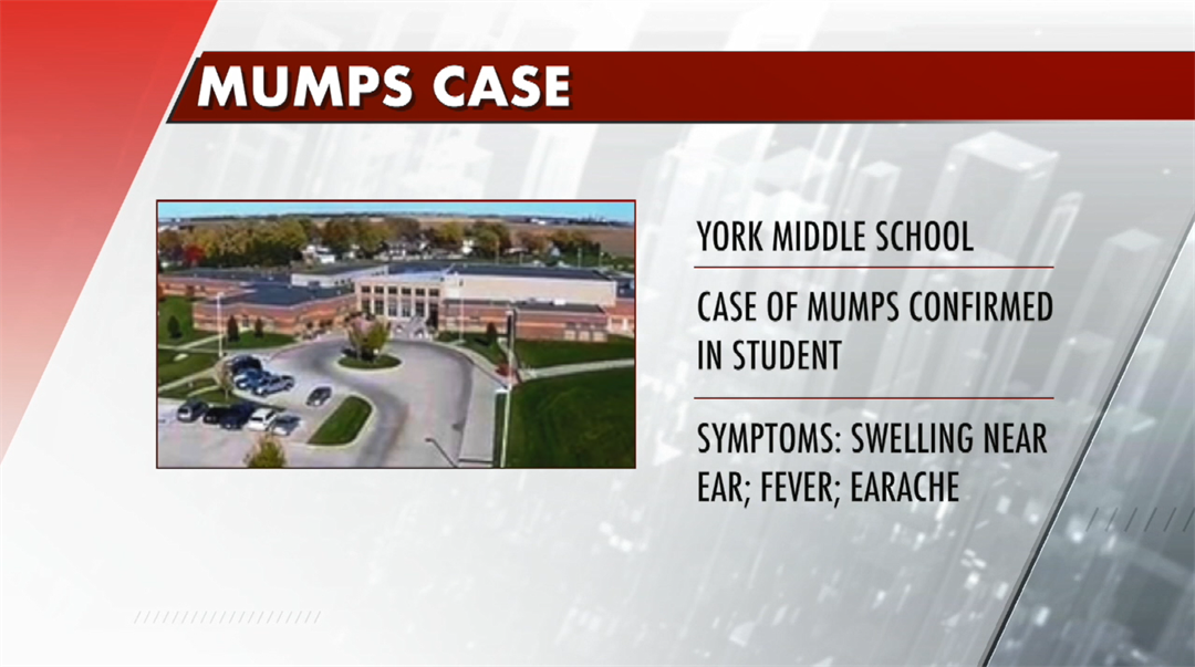 Mumps case confirmed in York Middle School student - NEWS CHANNEL NEBRASKA